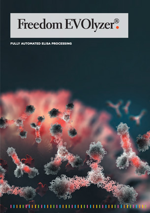 Download: Freedom EVOlyzer Fully Automated ELISA Processing | Brochure | pdf | 394607